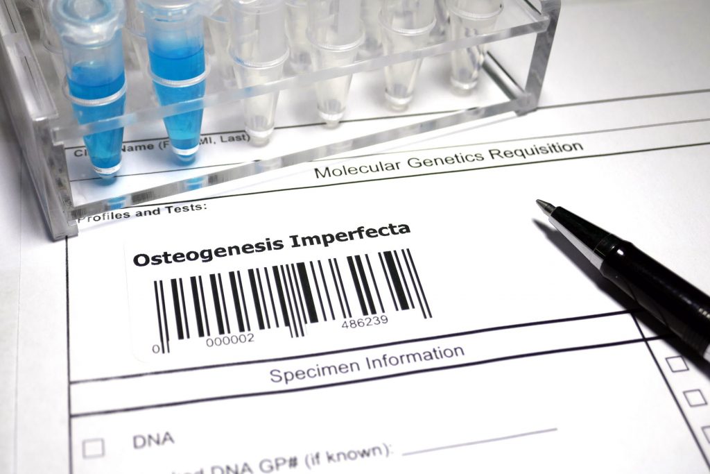 Osteogenesi imperfetta: cos'è e la terapia | Ohga!