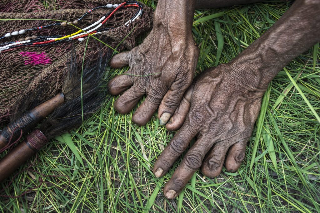 Kuro: cos'è e quali sono i sintomi | Ohga!