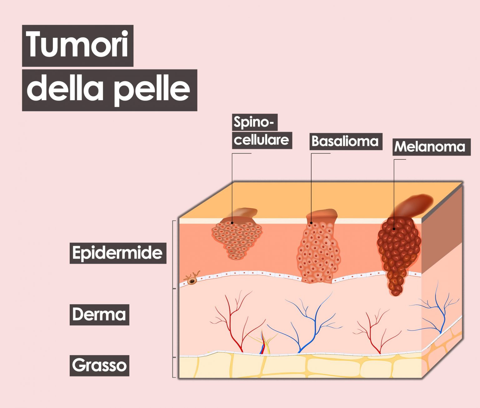 Come usare nel modo giusto le creme solari per limitare i rischi tumori ...